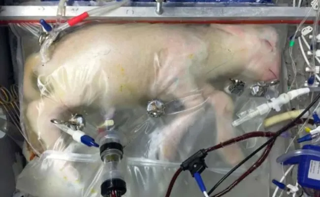 2017 - Artificial Womb Incubates Fetal Lamb | Next Nature